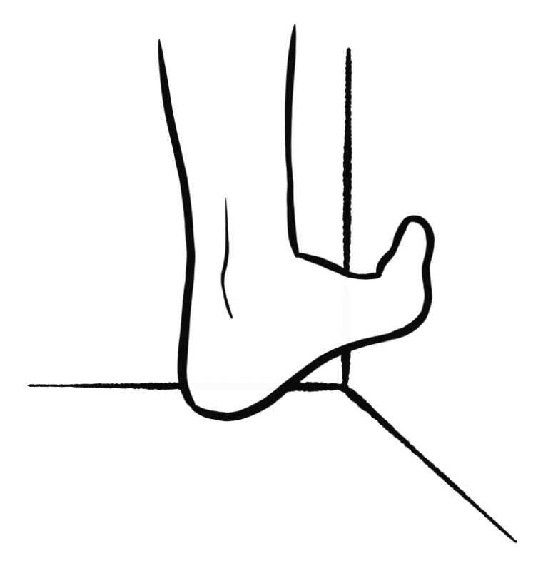 (VIDEO) ️ Deep layer plantar fascia and toe flexor stretch – exer-pedia
